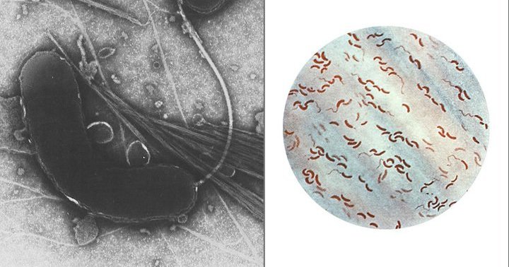Decoding cholera: How a comma-shaped bacterium creates an epidemic ...