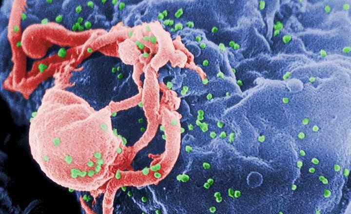 A new study explains how the tuberculosis bacteria activates HIV ...