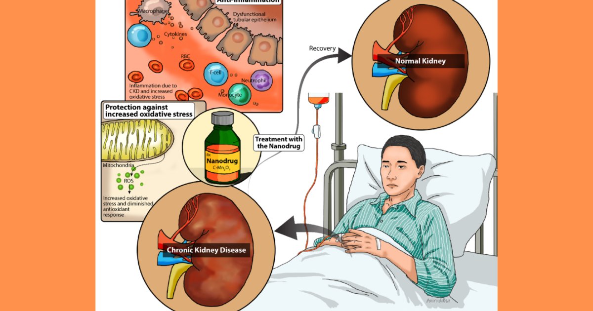 Redox medicine for the treatment of chronic kidney disease ...