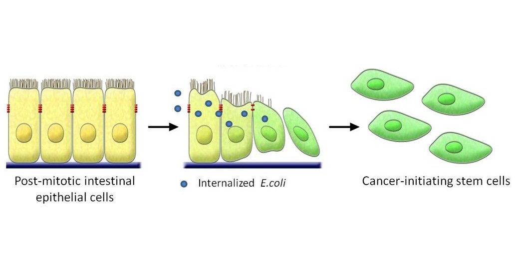 Inflamed colon and commensal E.coli – a cancerous combination ...