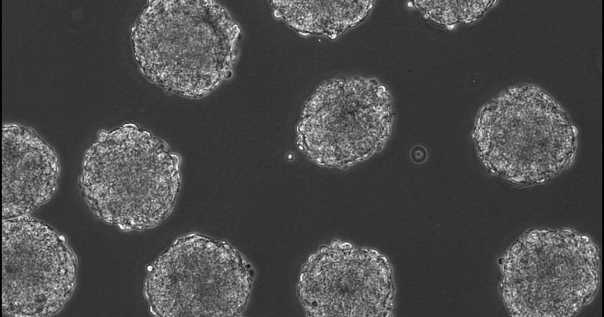 How stem cells retain their “stem” ness: The science of staying ...